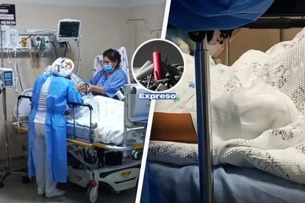 Ayacucho: Niño de 11 años pierde todos sus dedos y un ojo tras ...